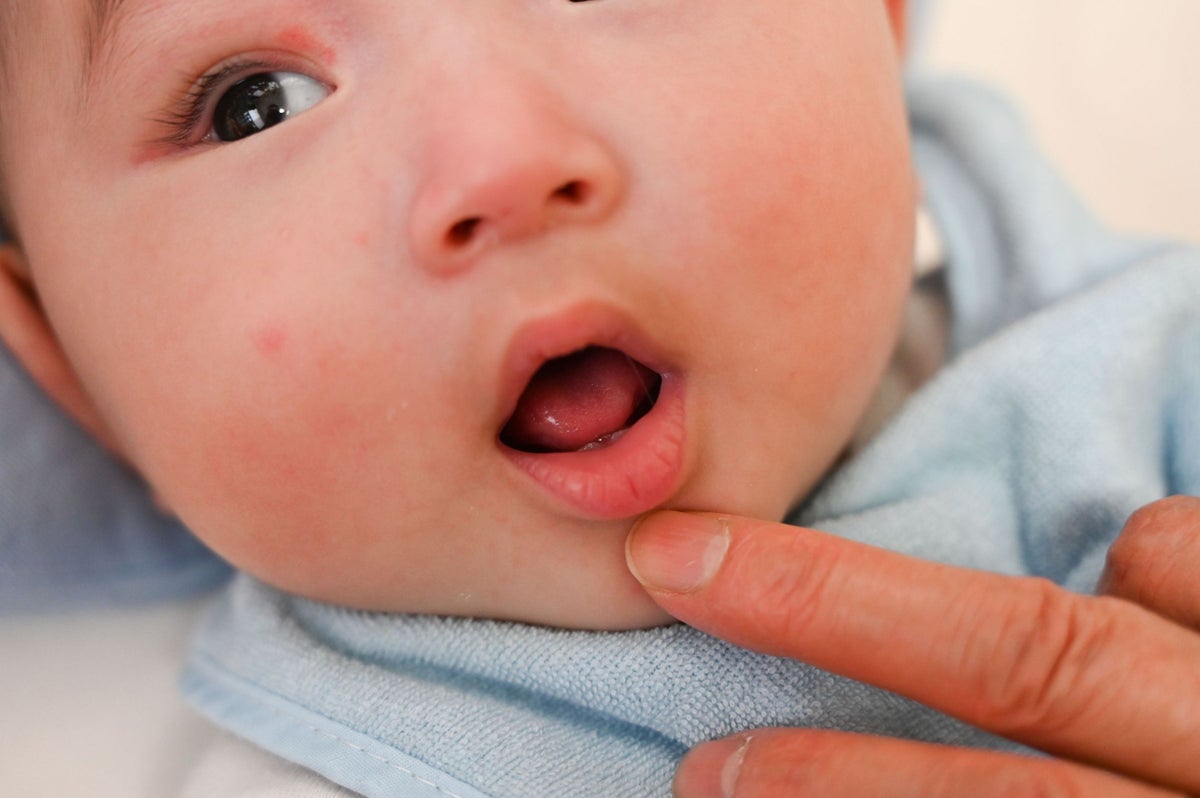 子供の歯磨きの悩み。歯医者さんがトコトン回答! Tbsラジオ